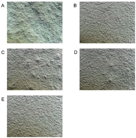 Cells Were Cultured With CoCl For H A E Cells Were Incubated With Download Scientific