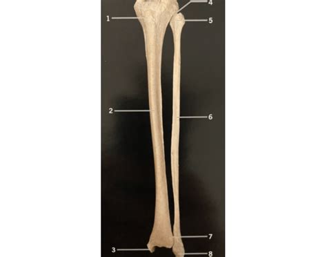 Left Tibia And Fibula Anterior View Quiz