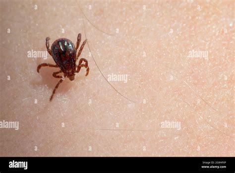 Dog Tick Anaplasmosis At Bonnie Tyler Blog