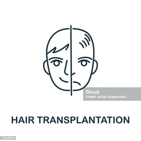 성형 수술 컬렉션에서 모발 이식 아이콘 간단한 라인 요소 템플릿 웹 디자인 및 인포 그래픽을위한 모발 이식 기호 갑상샘에 대한 스톡 벡터 아트 및 기타 이미지 Istock