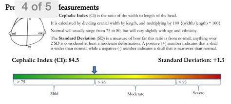 Brachycephaly Cephalic Index Chart A Visual Reference Of Charts Chart Master