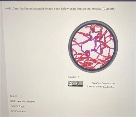 Solved 8 Describe The Microscopic Image Seen Below Using
