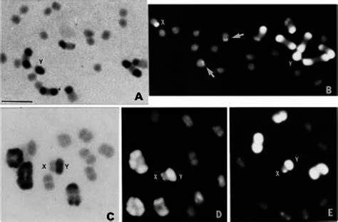 Mitotic Prometaphase And Meiotic Metaphase Of Triatoma Infestans