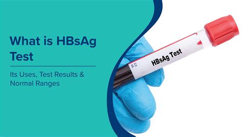 Esr Test Normal Range Symptoms And Causes Of High Levels Maxathome