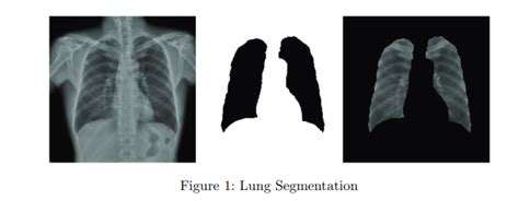 Evaluating Effect Of Lung Segmentation On Disease Prediction By