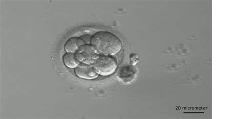 Example Of A Cleavage Stage Embryo Under 20× Magnification Download Scientific Diagram