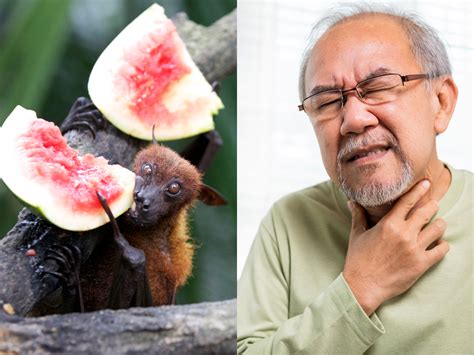 Nipah Virus Nipah Virus Causes Symptoms Best Treatment