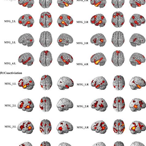 Whole Brain Resting‐state Functional Connectivity Rsfc And