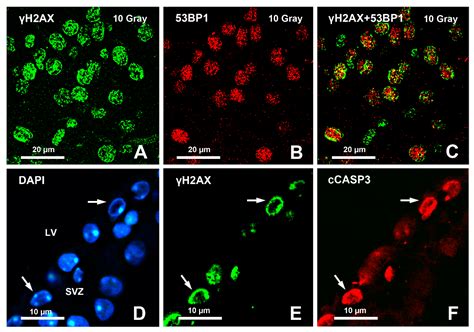 The Phosphorylated Form Of The Histone H2ax γh2ax In The Brain From