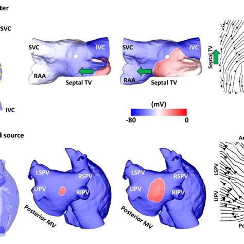 algorithm validation using clinical atrial tachycardia data a