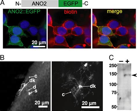 Subcellular Localization Of Ano2egfp Fusion Proteins A Anti Gfp