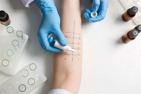 How Does Allergy Testing Work And What To Expect Dermatocare