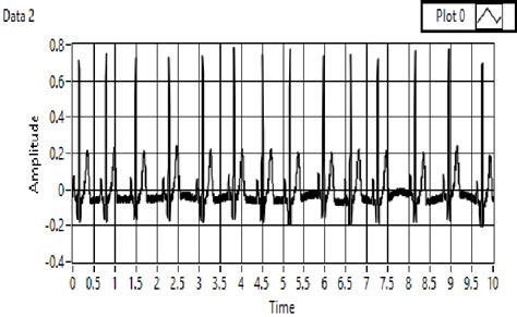 unfiltered ecg signal wavelet transform is applied to remove noise or