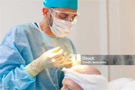 외과 의사는 머리에 주사를 줍니다 대머리 치료 모발 이식 수술실에서 외과 의사는 모발 이식 수술을 수행합니다 머리의 부분에서 모낭을 이동하는 외과 기술 가까운에 대한 스톡