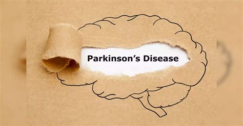 Parkinsons Disease New Study Uncovers Why Parkinsons Drug Levodopa