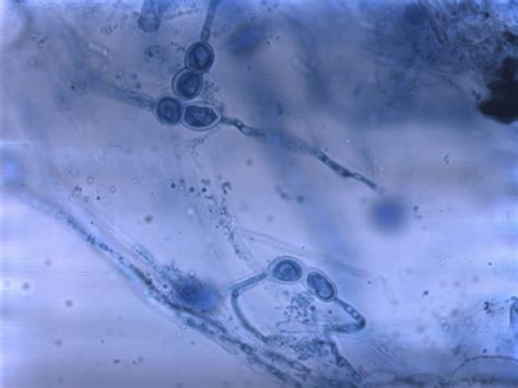 Can Anyone Help Me Identify These Phytophthora