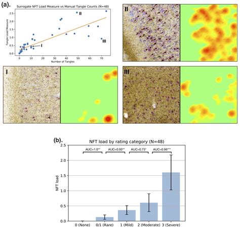Nft Burden Measure Derived Using The Weakly Supervised Learning
