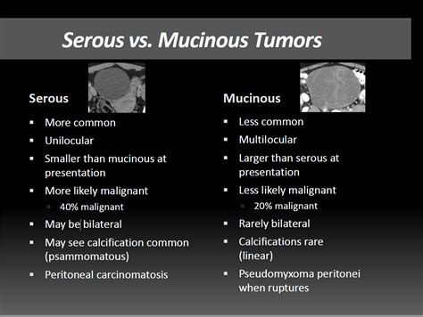 Serous Vs Mucinous Radiologist Headquarters