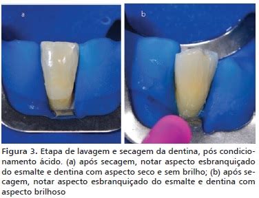 Protocolo Das Possibilidades Técnicas De Aplicação Dos Sistemas