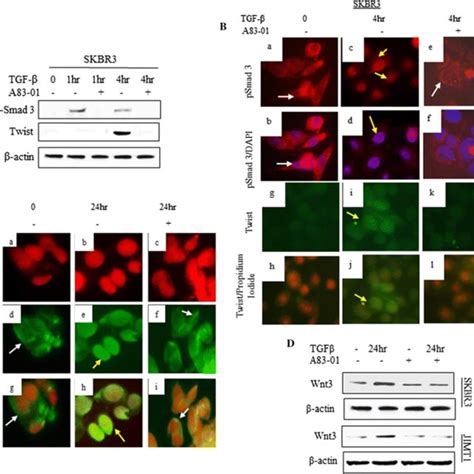 Targeting Tgf βri Alk5 Kinase By A83 01 Inhibited Tgf β Induced Twist Download Scientific