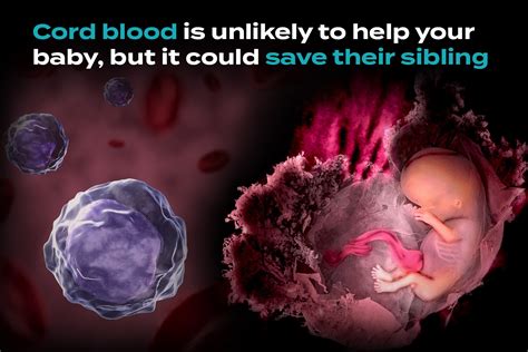 Not All Umbilical Cord Tissue Banks Are The Same Does