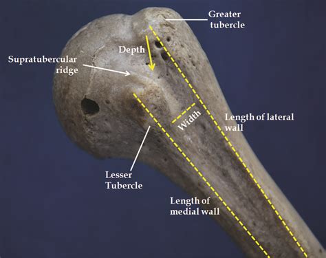 Medialbicipitalgrooveanatomy