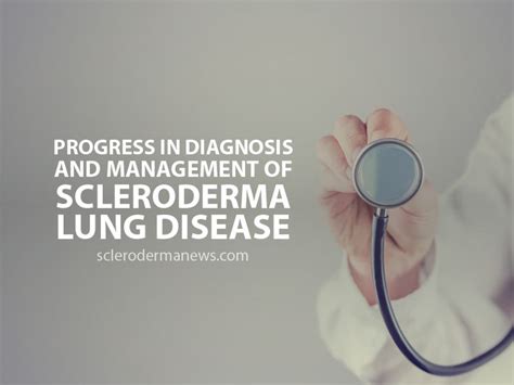 Progress In Diagnosis And Management Of Scleroderma Lung Disease Scleroderma Lung Disease