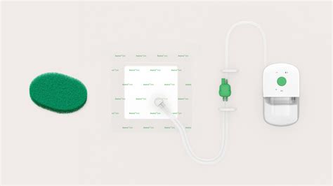 Our Npwt System