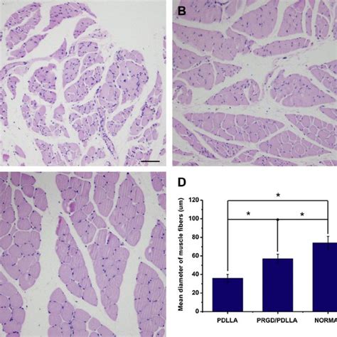 Cross Sections Of Regenerated And Normal Sciatic Nerves In Rats At 35 Download Scientific
