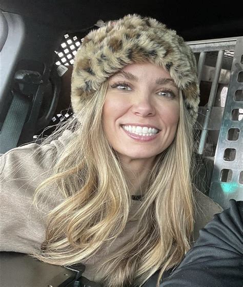 44 Best Rseptoplasty Images On Pholder Surgery Was This Morning