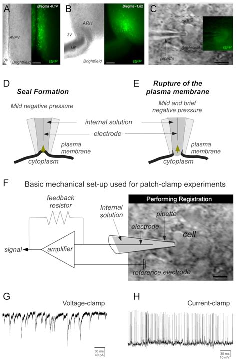 Determining A Test Growth Hormone Effect On Kisspeptin Neurons Using A