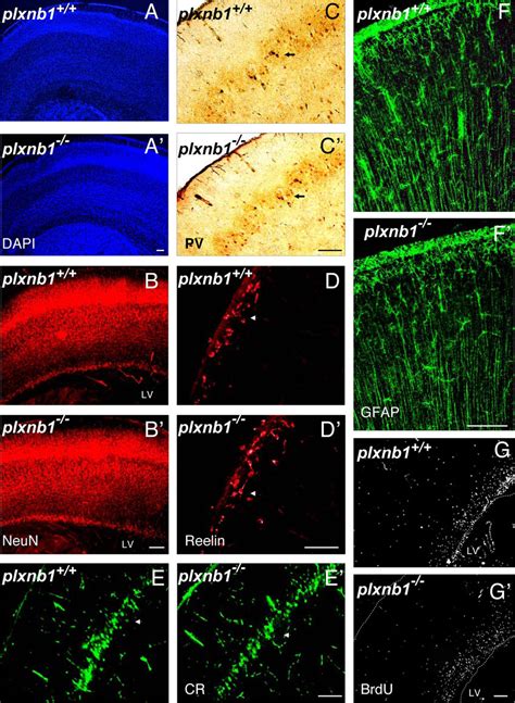 The Architecture Of The Developing Neocortex In Mice Lacking Plexin B1 Download Scientific