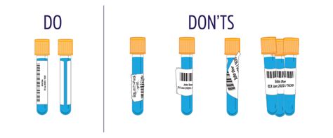 The Dos And Donts Of Labeling Specimens For Pathology Labtag Blog