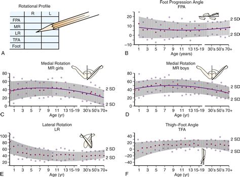 Gait Disturbances Clinical Tree