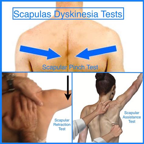 Scapular Reflex