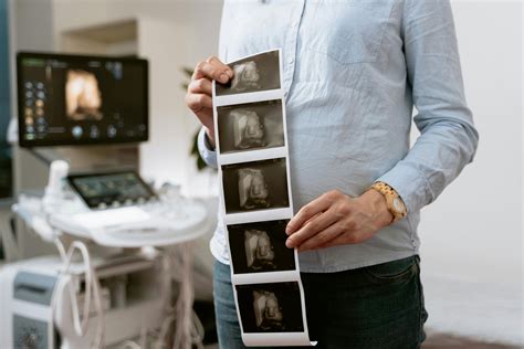 maximizing healthcare efficiency with custom medical image analysis