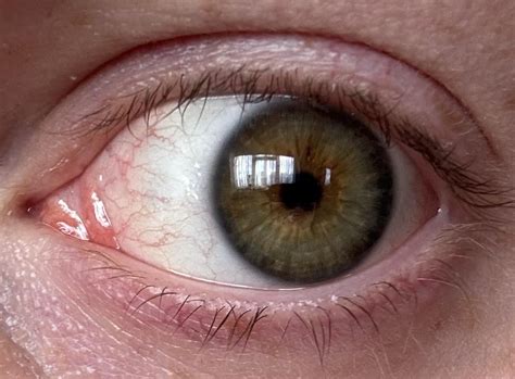 eyes in different lighting conditions r eyes