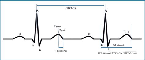 figure 1 from the association between tp e interval tp e qt and tp e