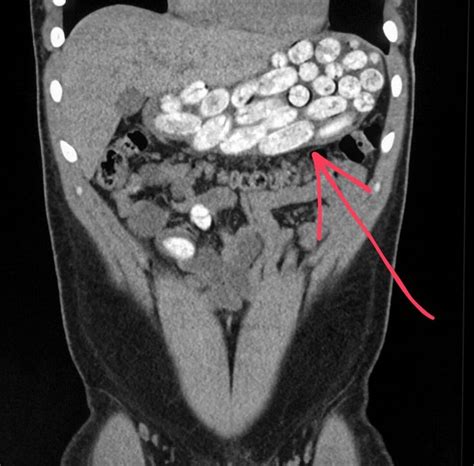 Best CT Scans Images On Pinterest