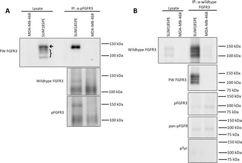 Fgfr3 Signaling And Function In Triple Negative Breast Cancer Pmc