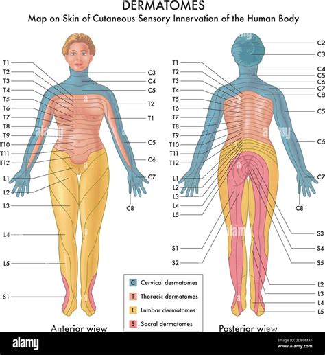 What And Where Are Dermatomes What Are Dermatomes Ruaue