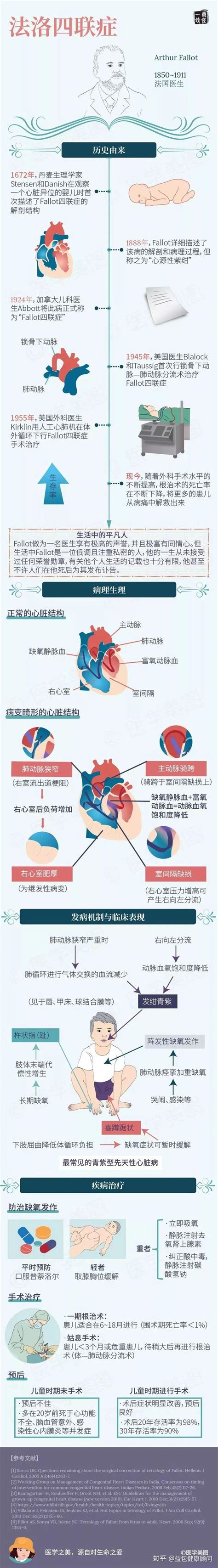 名称故事丨法洛四联症 知乎