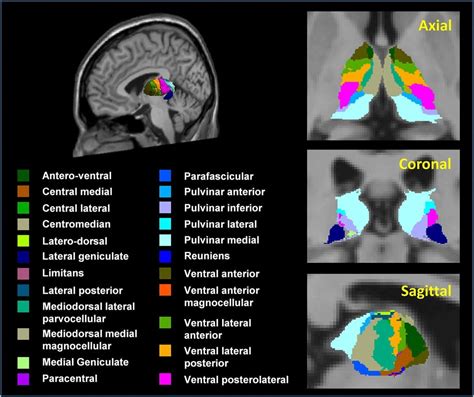 Altered Brain Morphology And Functional Connectivity In Postmenopausal