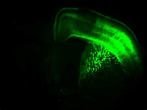 Projects Asher Albertson Lab Washington University In St Louis