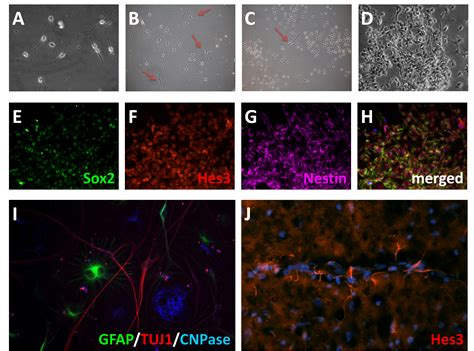 Growing Neural Stem Cells From Conventional And Nonconventional Regions