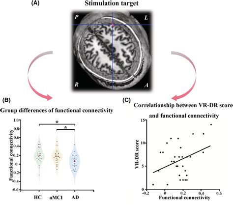 Cross‐sectional Experiment—identification Of Stimulation Locations A