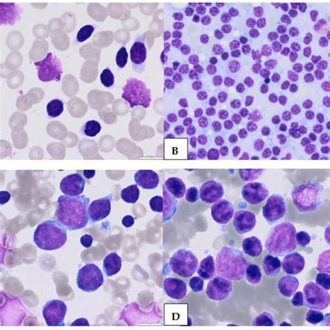 Morphological Features Of Classic A B And Large C D Cll Cells Download Scientific Diagram