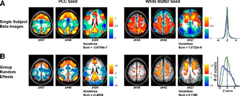 global signal regression mandates negative correlations at the single