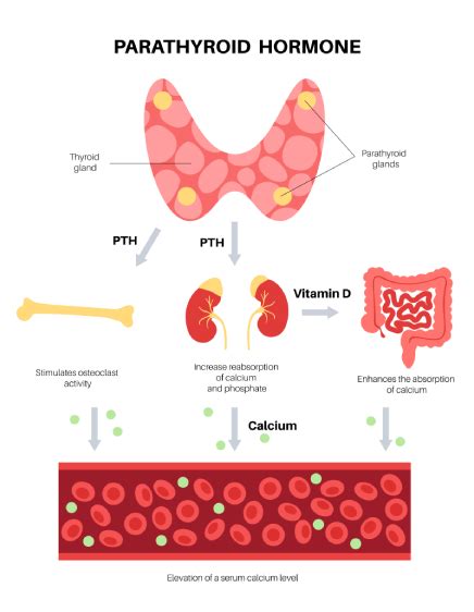 Hyperparathyroidism Understanding The Overactive Parathyroid Glands
