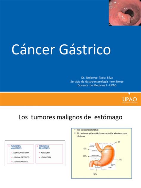 Cáncer Gástrico Epidemiología Y Tratamiento Pdf Cáncer Metástasis